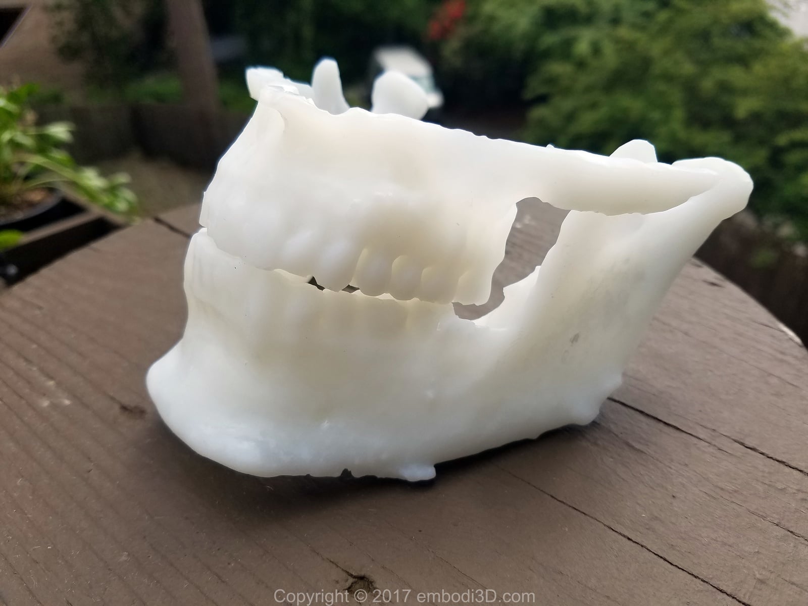 3D Printing Teeth Tutorial: How to Easily Create 3D Printable Dental ...