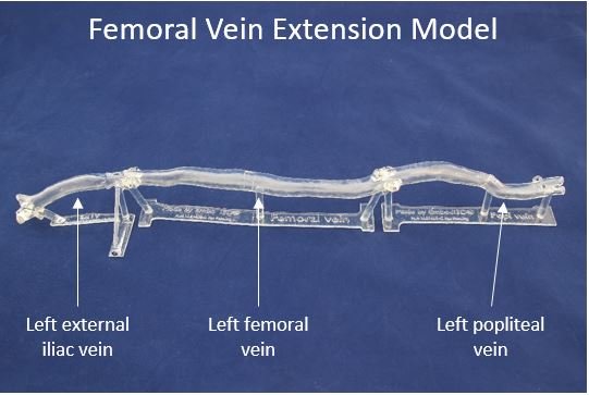 Femoral Vein Extension Model - The Embodi3D.com Blog - embodi3D.com