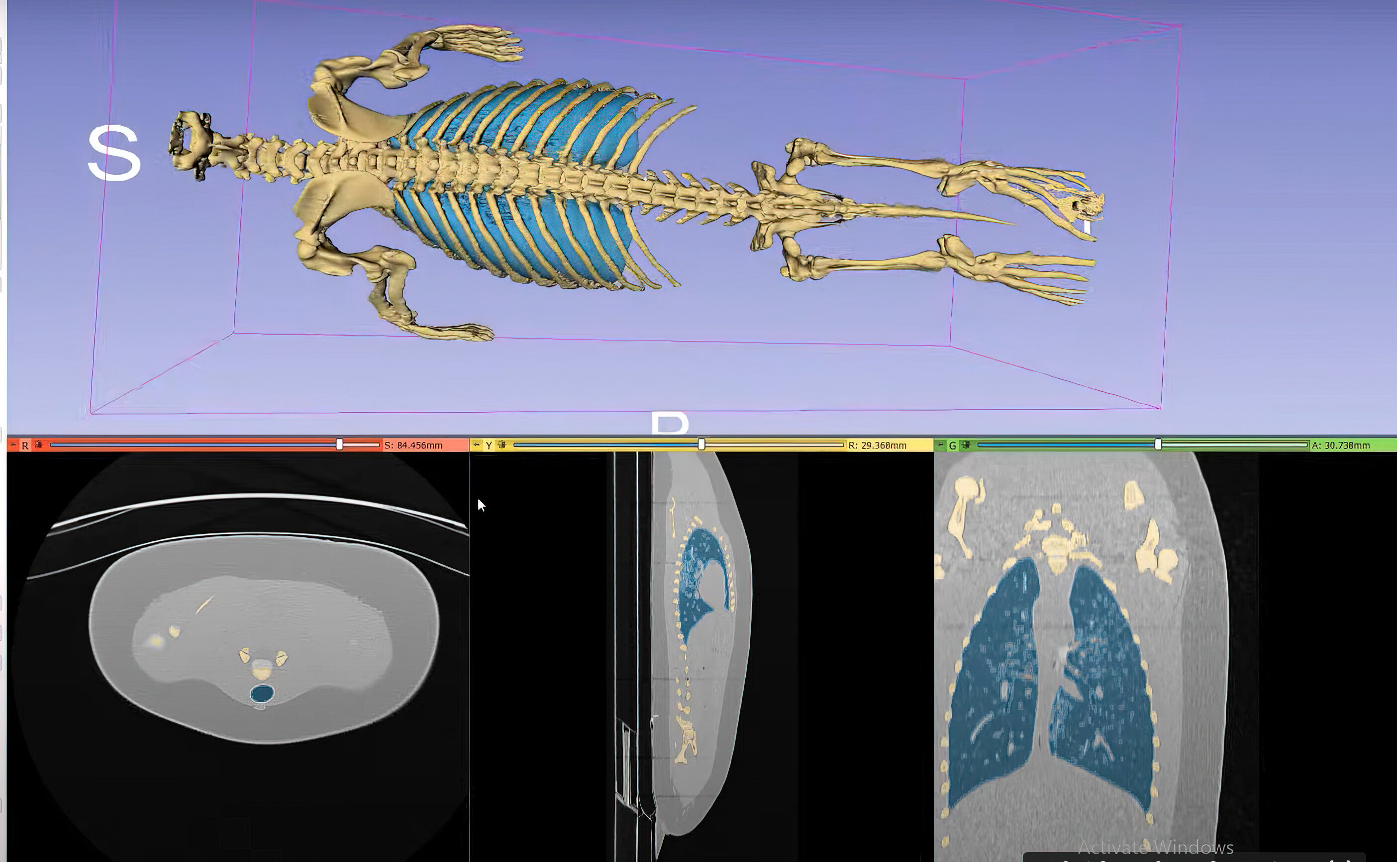 printable 3d brain from MRI scan, - MRIs - embodi3D.com
