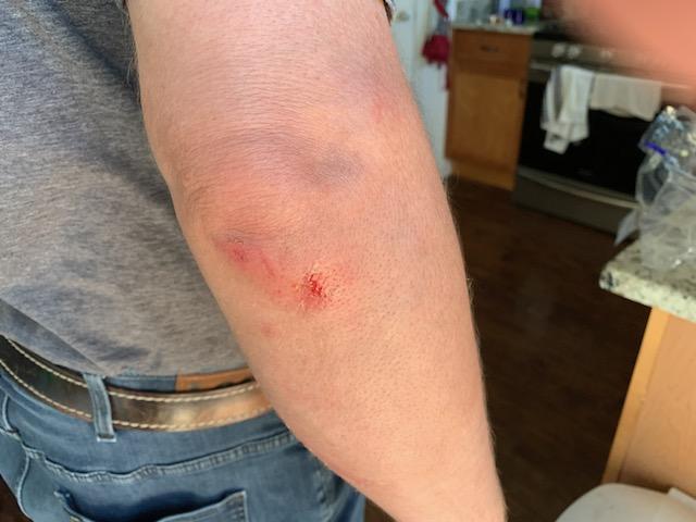 1st Full Speed Crash on V11 - Riding Safety and Protective Gear ...