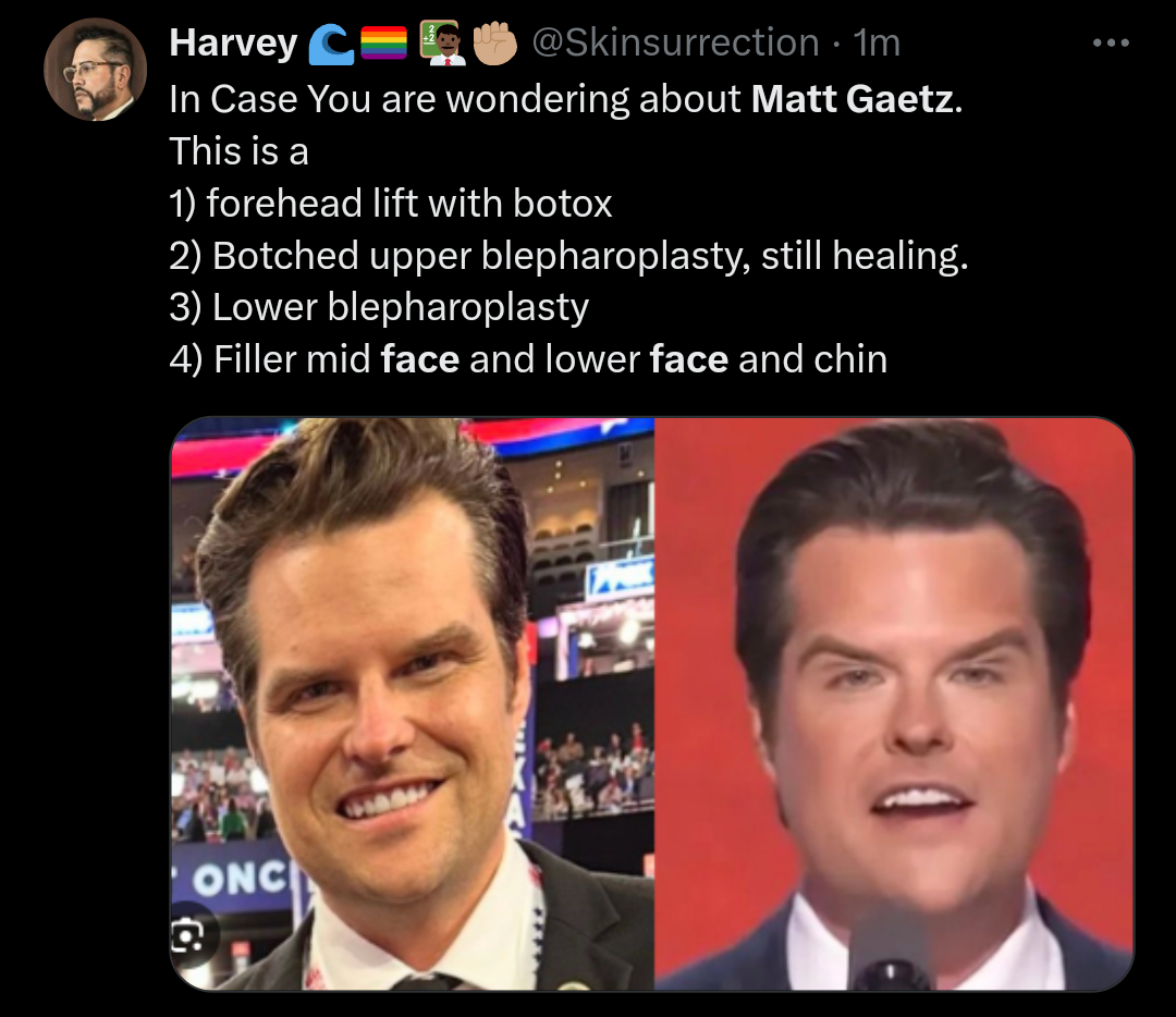 Twitter Reacts to Dramatic matt gaetz Transformation at RNC Convention ...