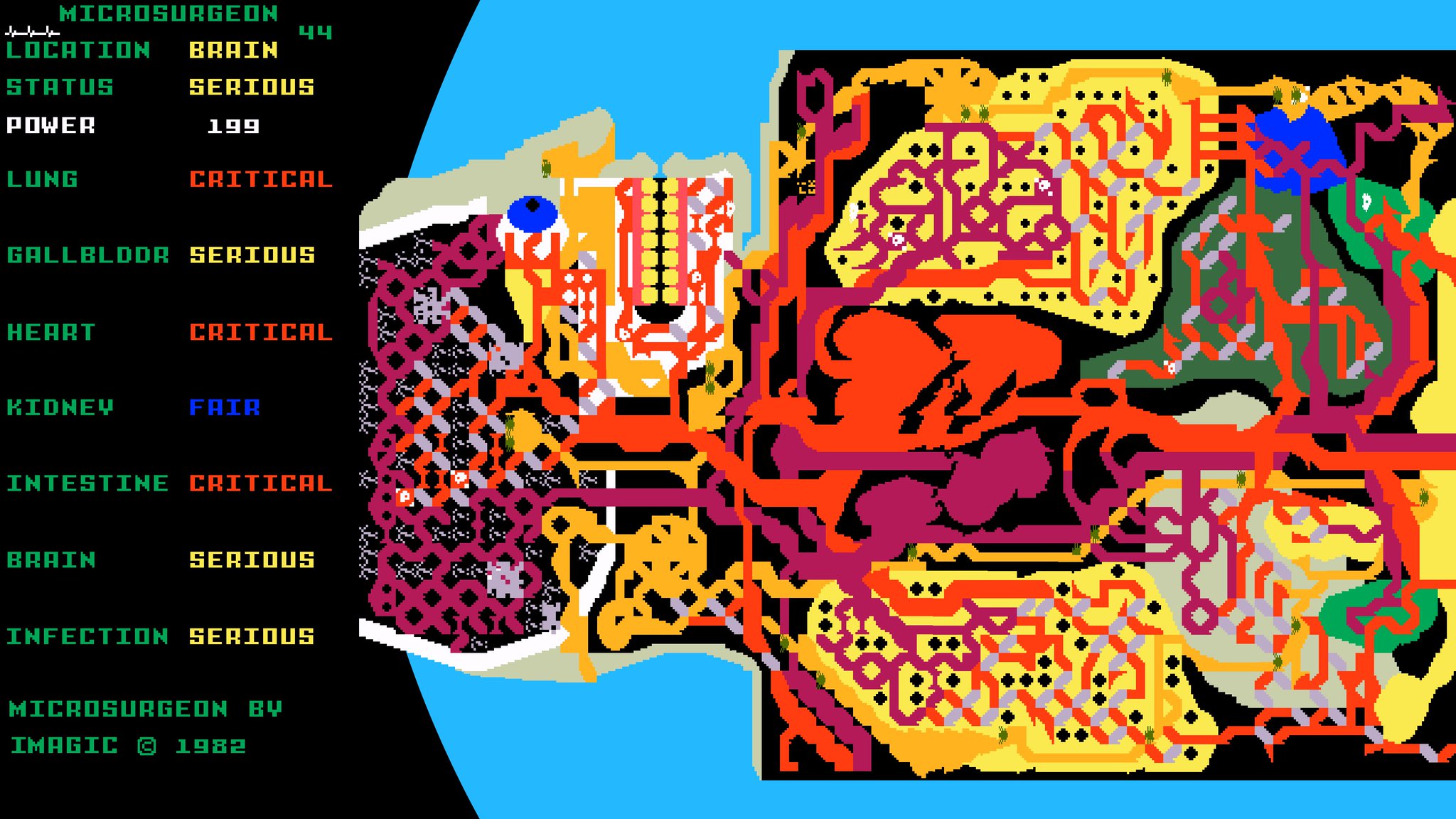 Microsurgeon 4K resolution wallpaper - Intellivision / Aquarius ...