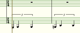 Score not showing triplets correctly - Logic Pro - Logic Pro Help