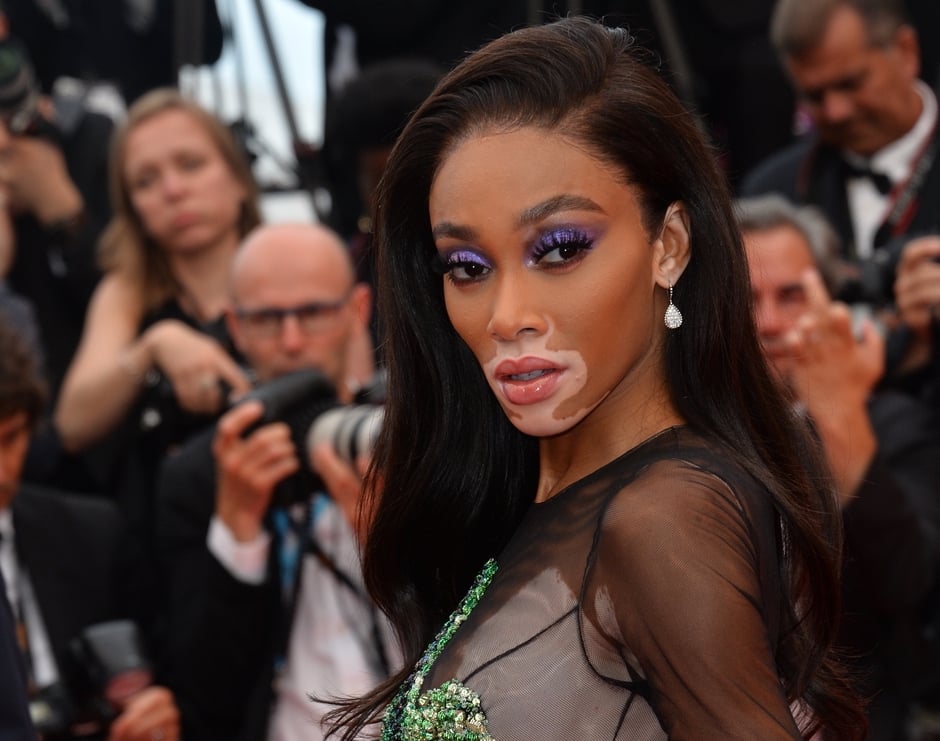 Vitiligo supermodel Winnie Harlow gets commemorated with wax figure at ...